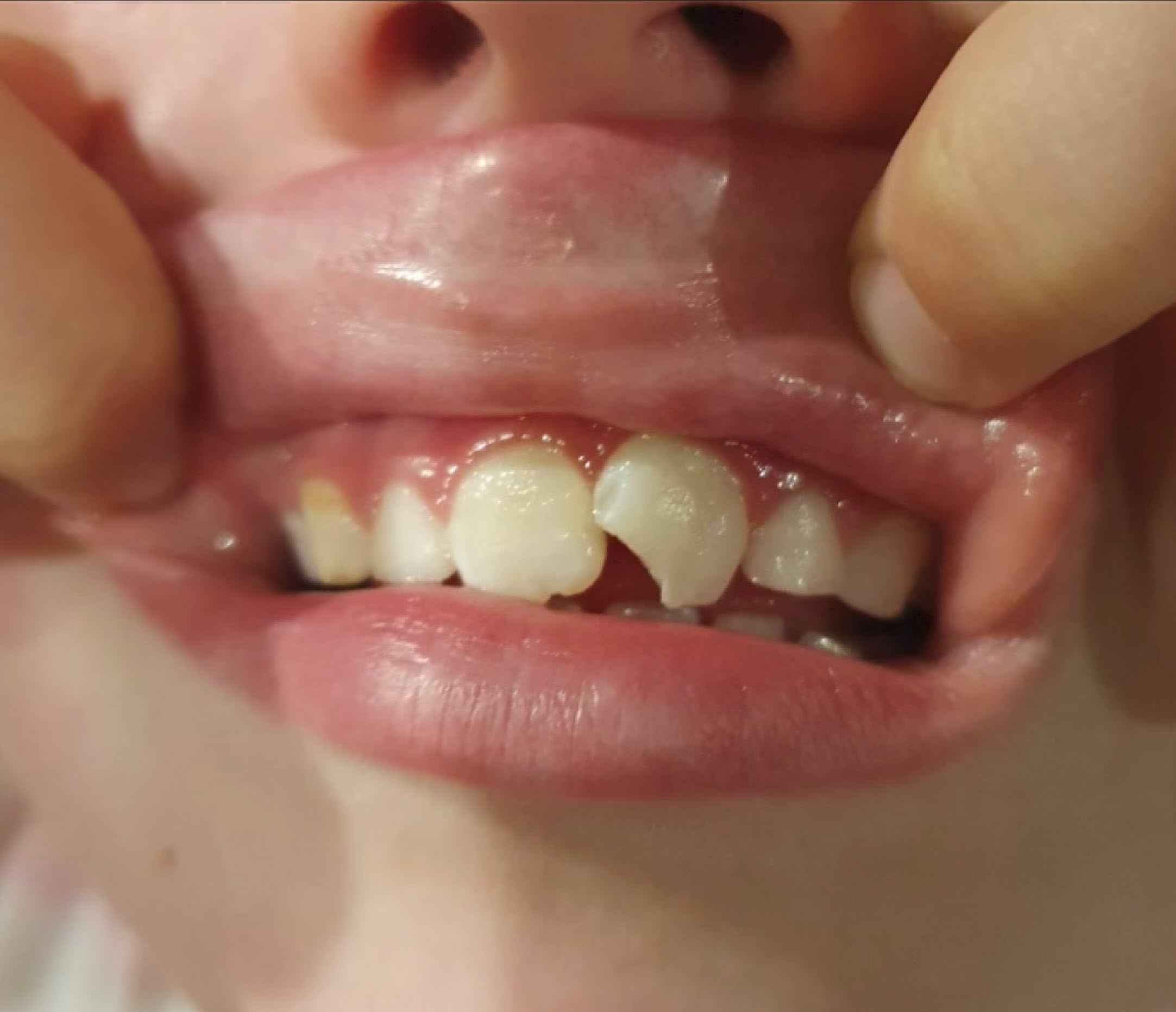 The Ultimate Guide to Finding the Best Emergency Dentist in Brisbane ... The Ultimate Guide to Finding the Best Emergency Dentist in Brisbane ...